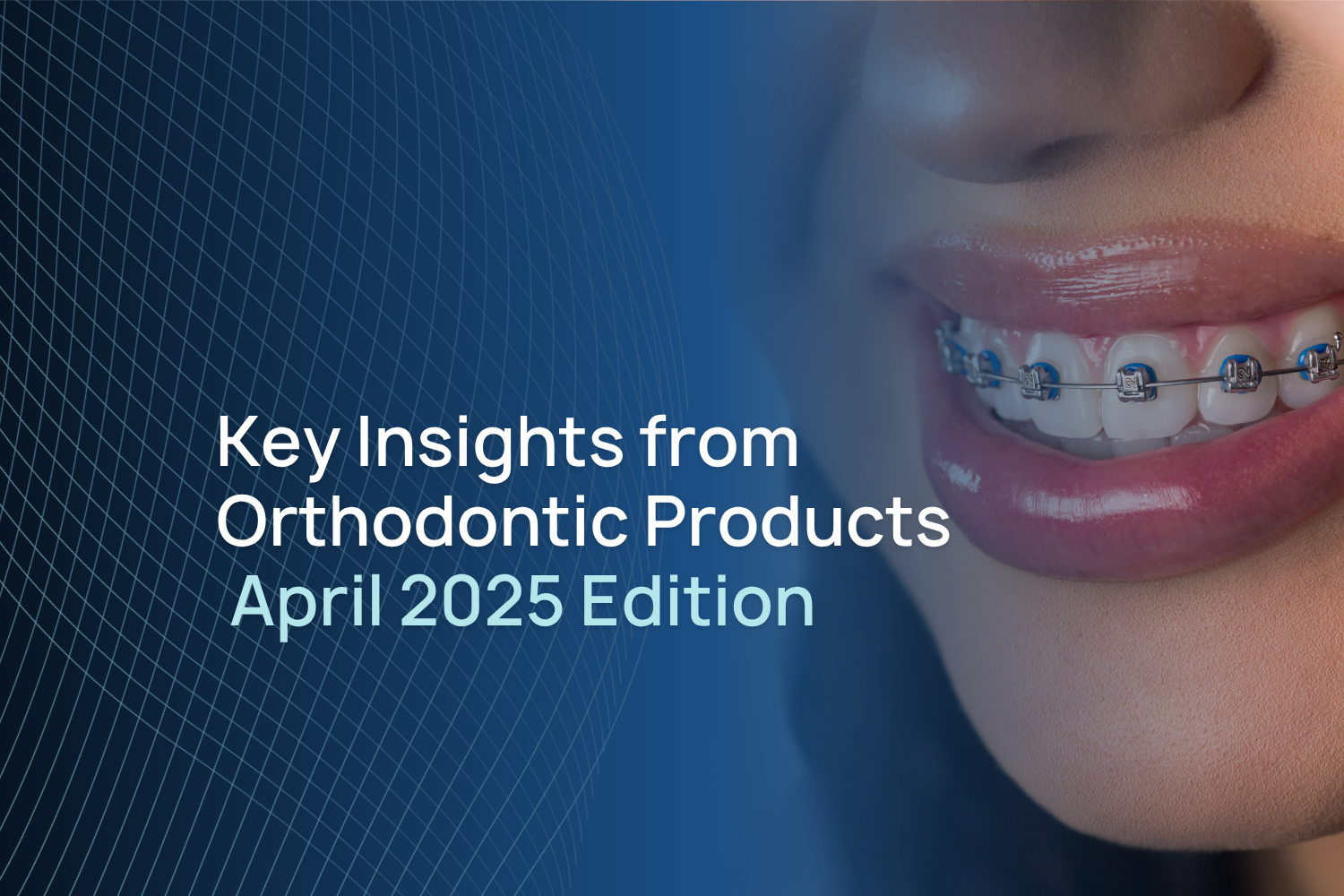 KLOwen Orthodontics | Full Custom Digital Solution